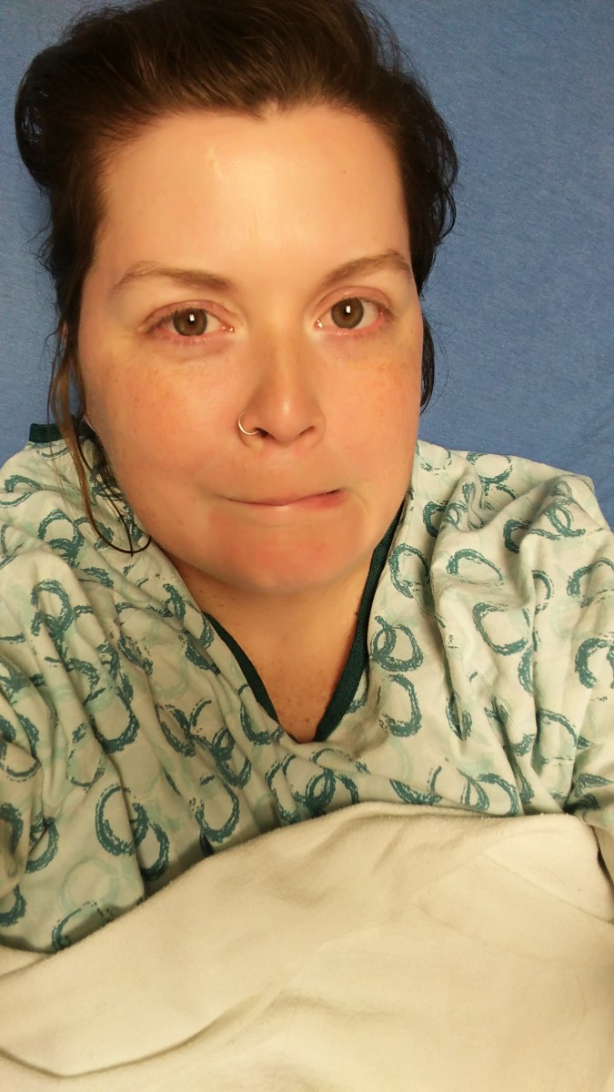 I Have Alot of Gall (Still) | welderbeth